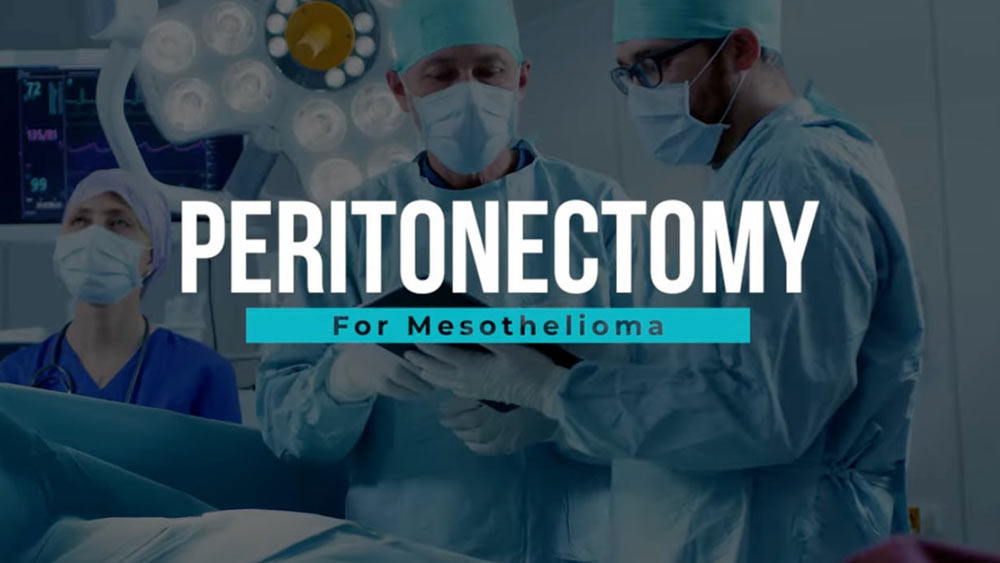 Peritonectomy for Mesothelioma | What to Expect & Risks